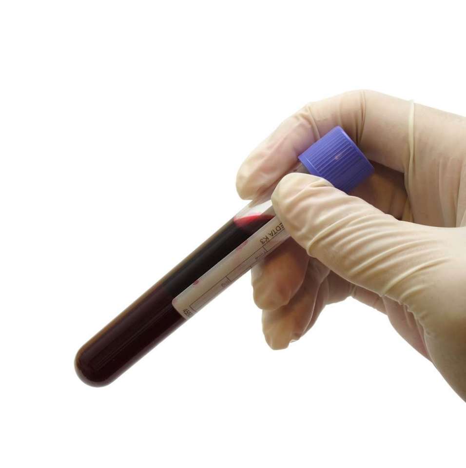 Accréditation de l’Integrated BioBank of Luxembourg (IBBL) selon la ...